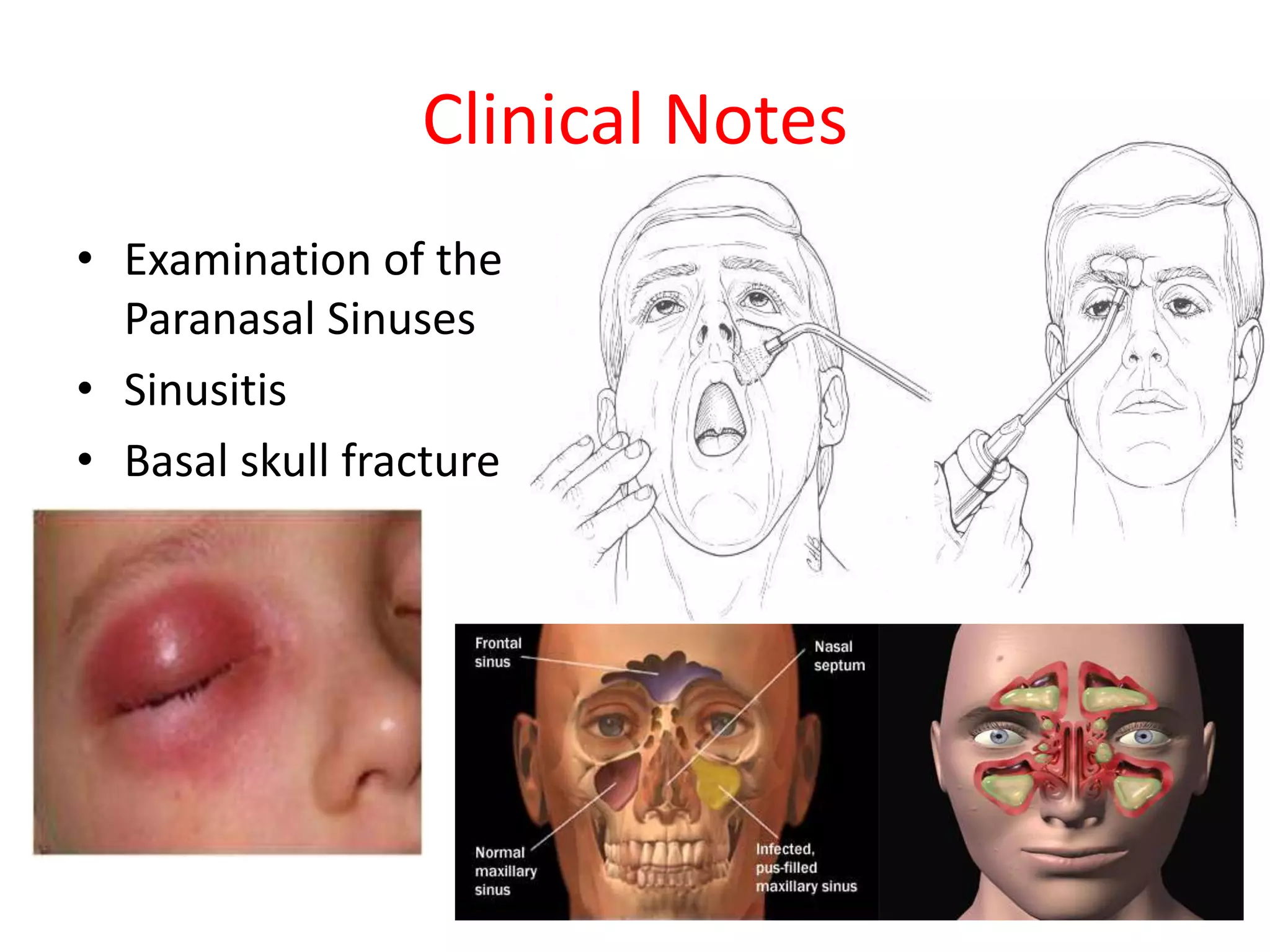 Nose and Paranasal Sinus.pptx