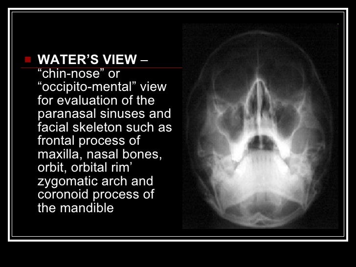 Nose and paranasal sinuses