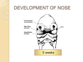 Nose and paranasal sinuses | PPTX