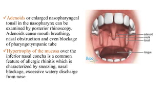 Nose and paranasal sinuses. | PPTX