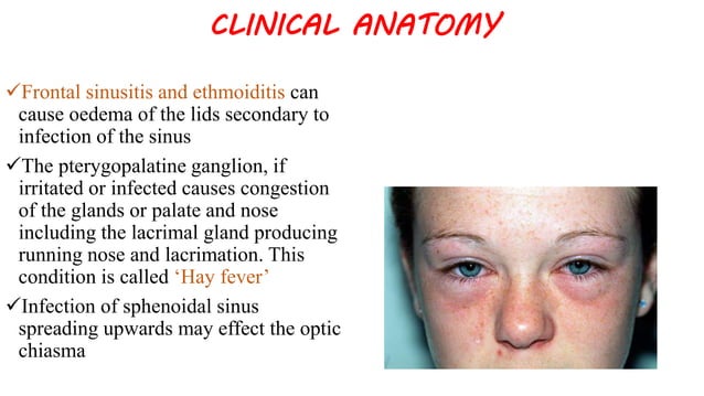 Nose and paranasal sinuses. | PPTX | Ear, Nose and Throat Conditions ...