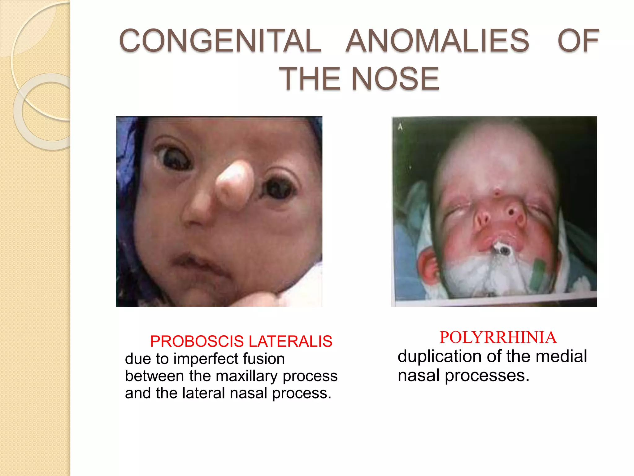 nose and paranasal sinuses EXCELLENT SLIDES TO CULL FROM NOSE SINUSES ...