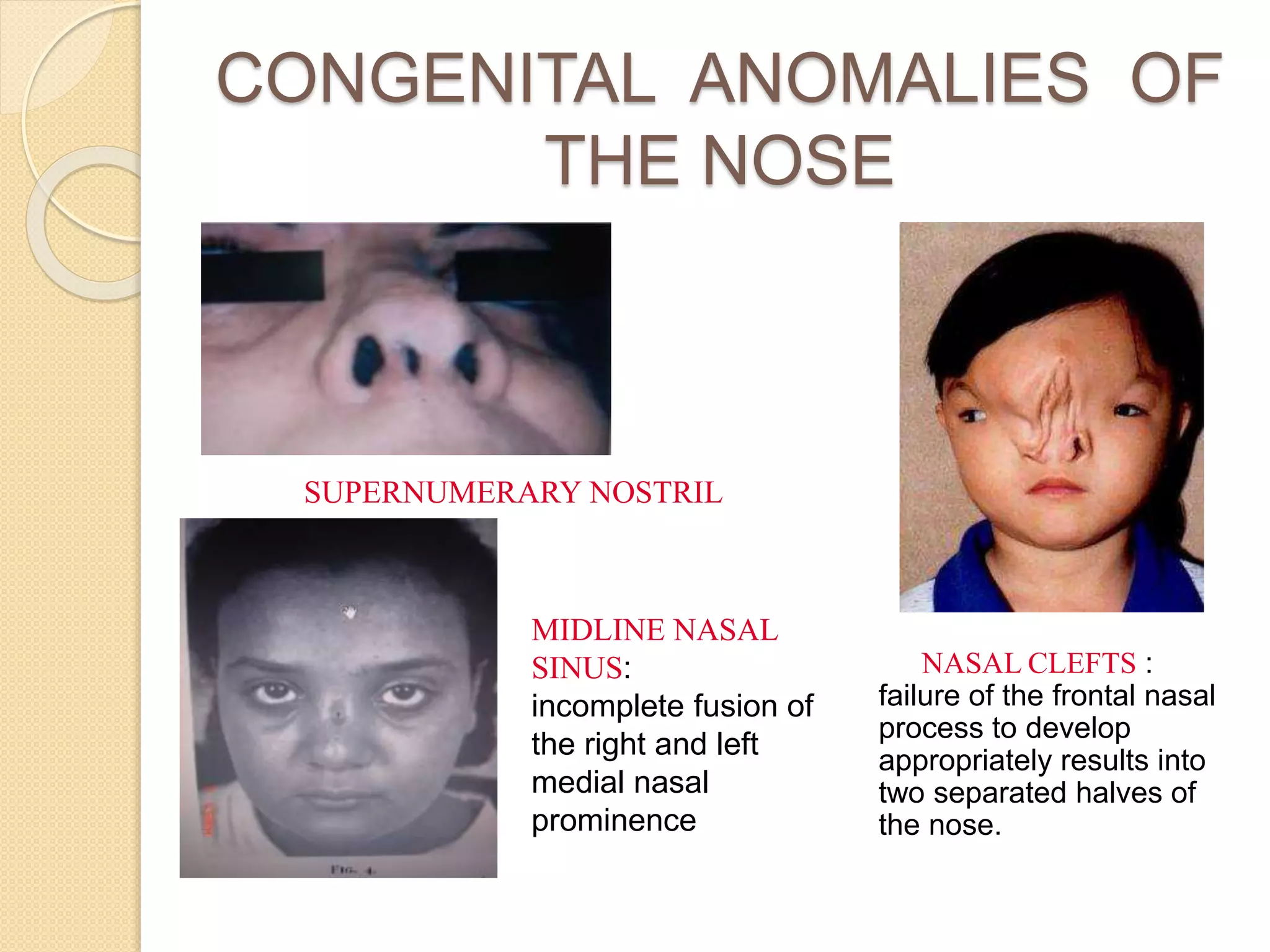 nose and paranasal sinuses EXCELLENT SLIDES TO CULL FROM NOSE SINUSES ...