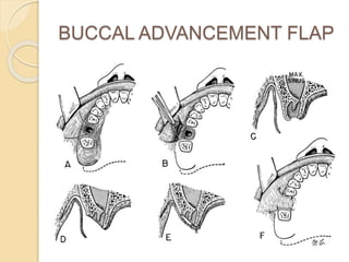 nose and paranasal sinuses EXCELLENT SLIDES TO CULL FROM NOSE SINUSES ...