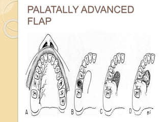 nose and paranasal sinuses EXCELLENT SLIDES TO CULL FROM NOSE SINUSES ...