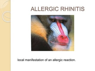 nose and paranasal sinuses EXCELLENT SLIDES TO CULL FROM NOSE SINUSES ...