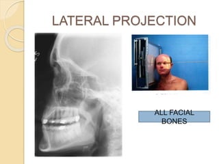 nose and paranasal sinuses EXCELLENT SLIDES TO CULL FROM NOSE SINUSES ...