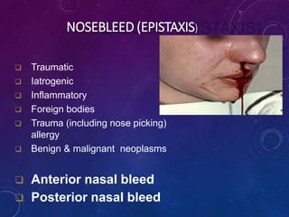 Nose and para nasal sinus meher | PPTX