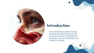 Nose and Sinuses ( nasal anatomy, structure of the nose and paranasal ...