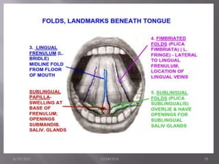 Plica Sublingualis Swelling