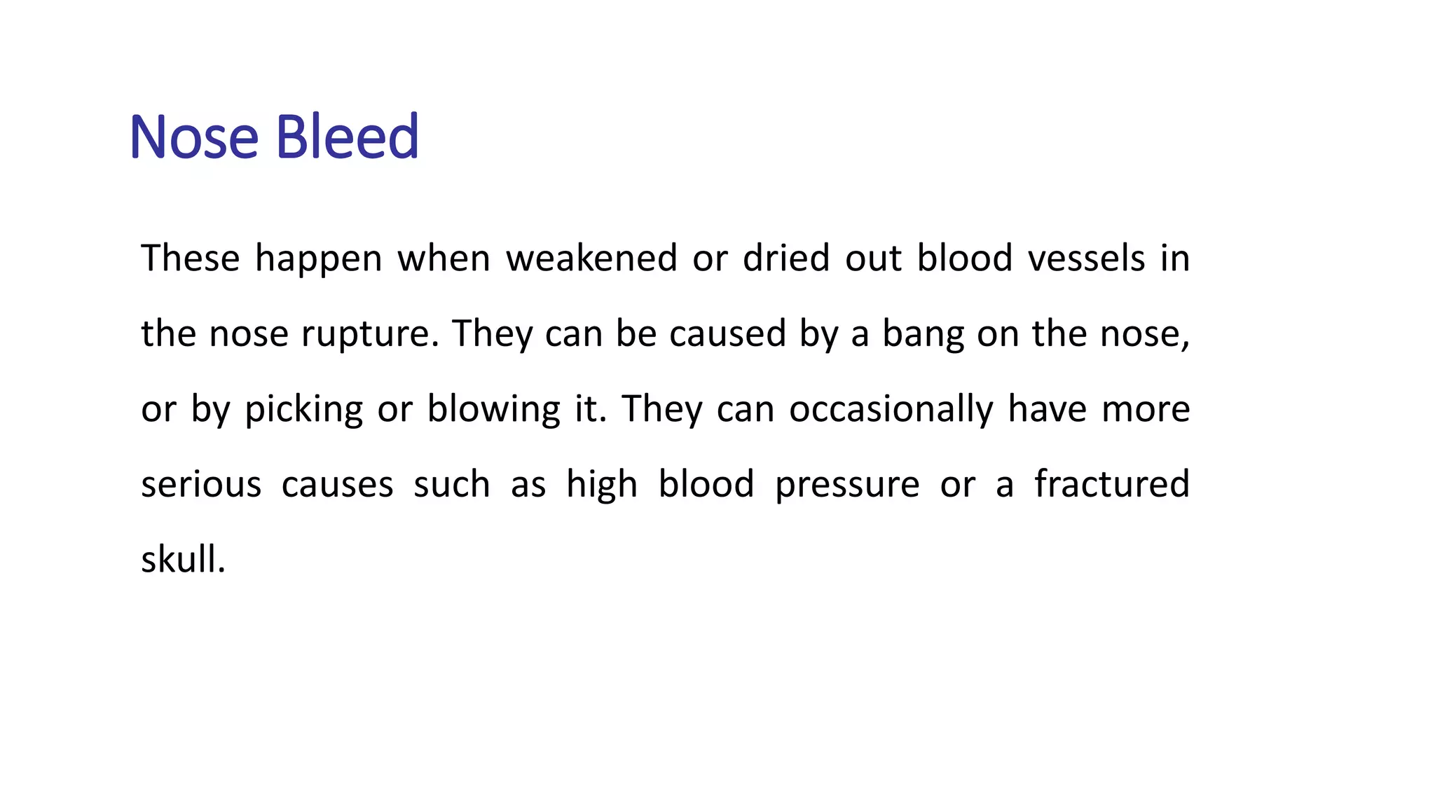 Nose bleed | PPTX