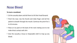 Nose bleed | PPTX