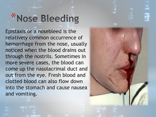 Nose Bleeding, Severe Bleeding & Burns.pptx