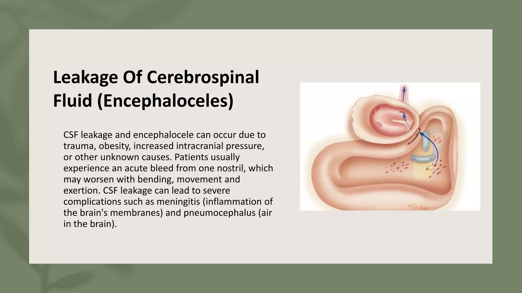 Nose Doctor In Ropar | PPT