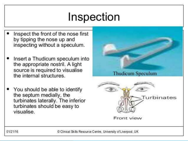 Nose examination ppt | PPTX | Ear, Nose and Throat Conditions ...