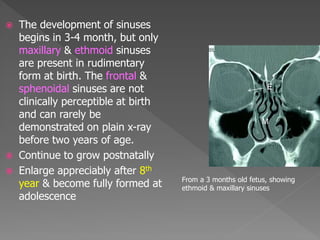 Nose, Nasal cavity & Paranasal sinuses.ppt