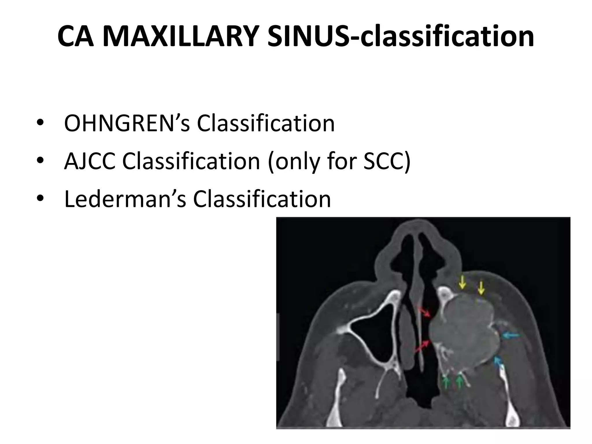 Nose and PNS Carcinoma (for UNDERGRADUATES) | PPTX