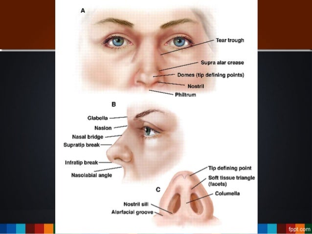 Nose, paranasal sinuses and ear