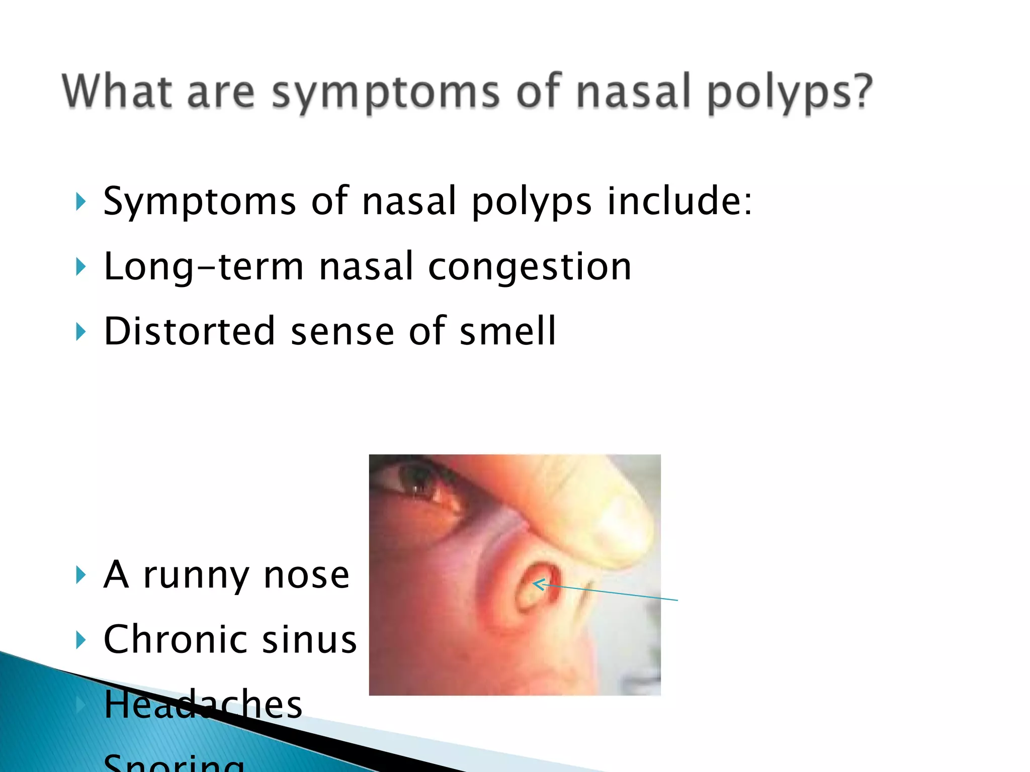 Nose problems | PPT