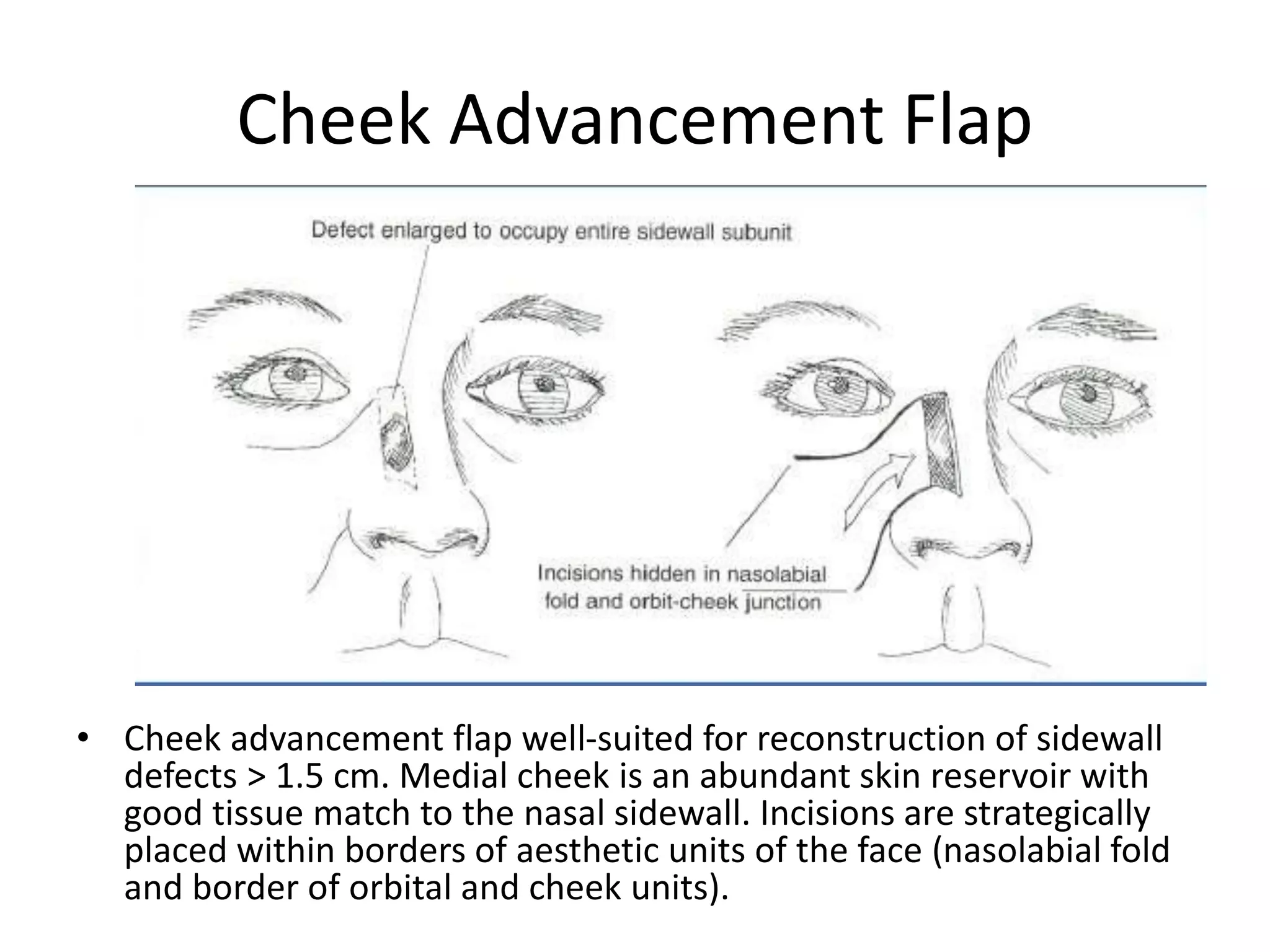 Nose reconstruction | PPTX