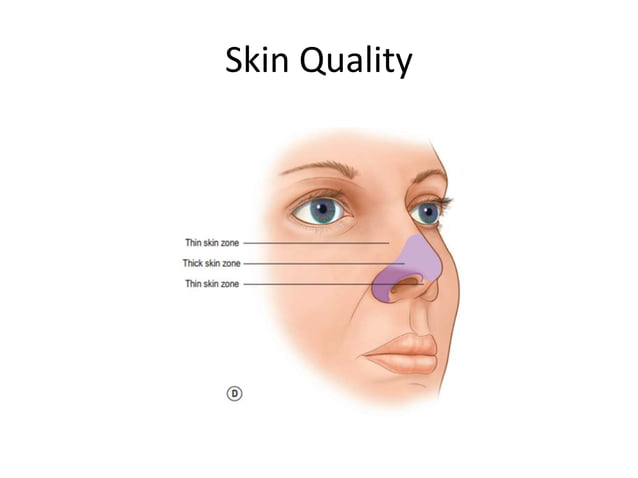 Nose reconstruction | PPTX