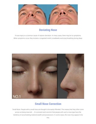 Nose reshaping cost in hyderabad | PDF