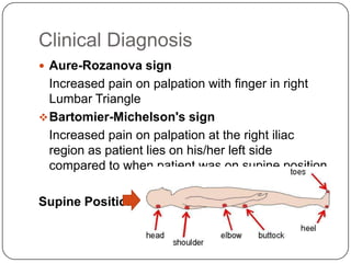 Appendicitis | PPT
