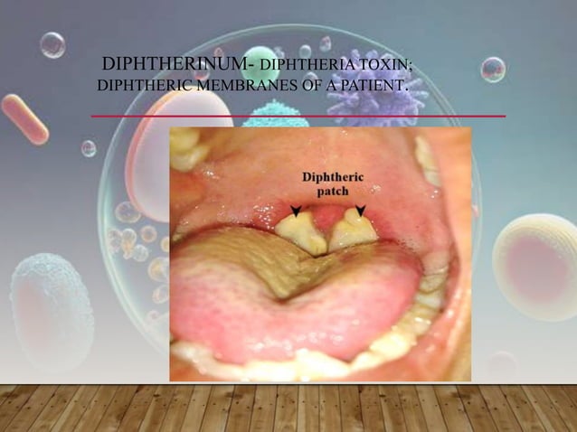 Nosodes in Homeopathy.pptx