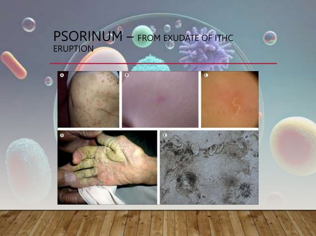 Nosodes in Homeopathy.pptx