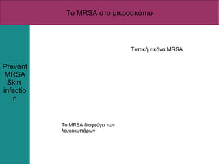 MRSA | PPT