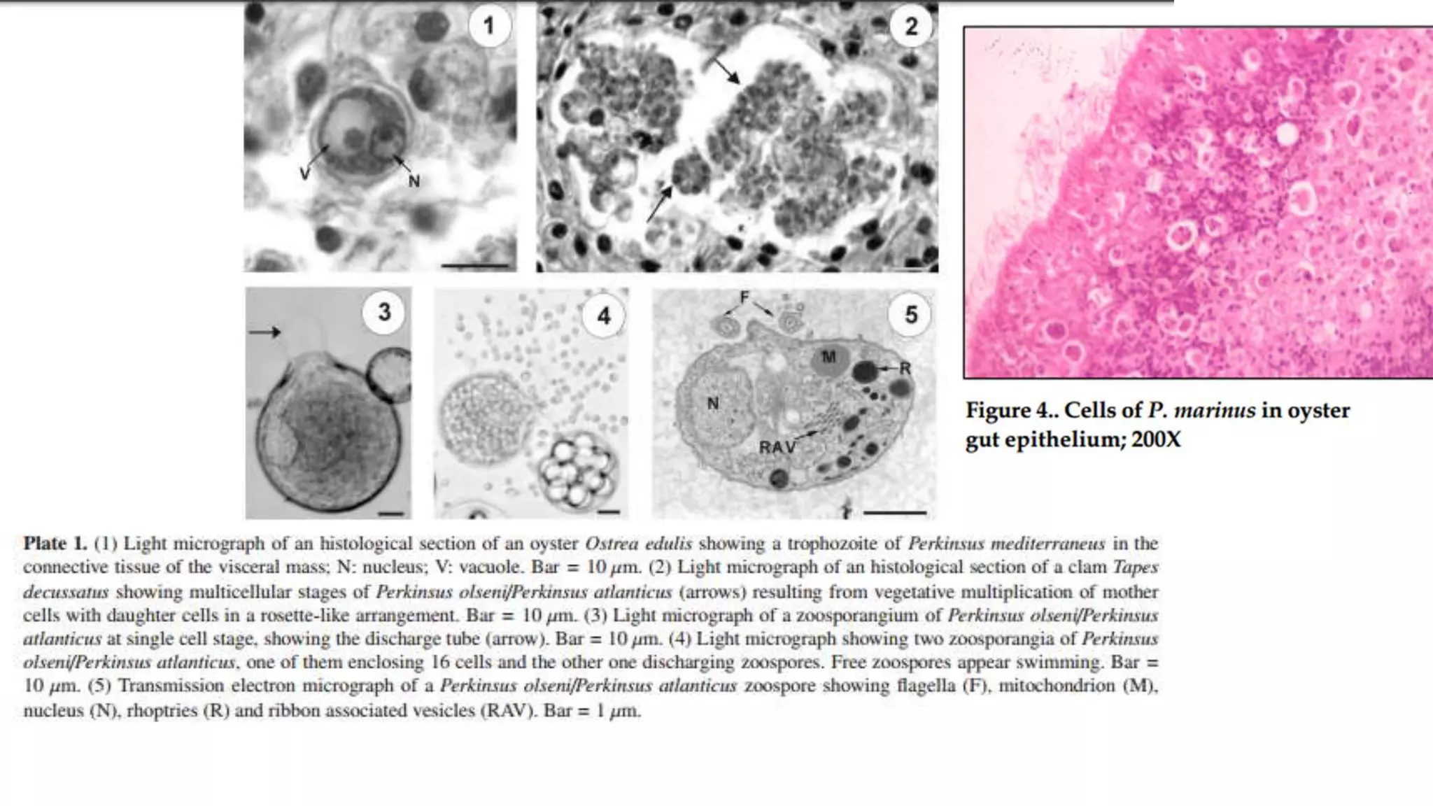 Notable Diseases of Shellfish | PPTX