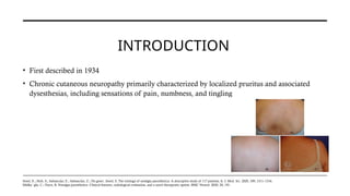 Notalgia Paresthetica; A Chronic Cutaneus Sensory Neuropathy | PPTX