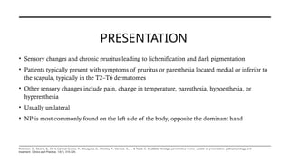Notalgia Paresthetica; A Chronic Cutaneus Sensory Neuropathy | PPTX