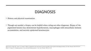 Notalgia Paresthetica; A Chronic Cutaneus Sensory Neuropathy | PPTX
