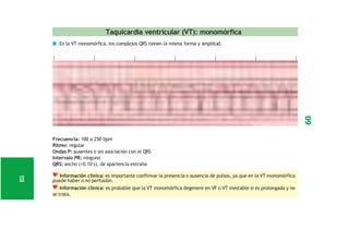 notas-de-ecg-guia-de-interpretacion-y-manejo-shirley-a-jones-2012.docx