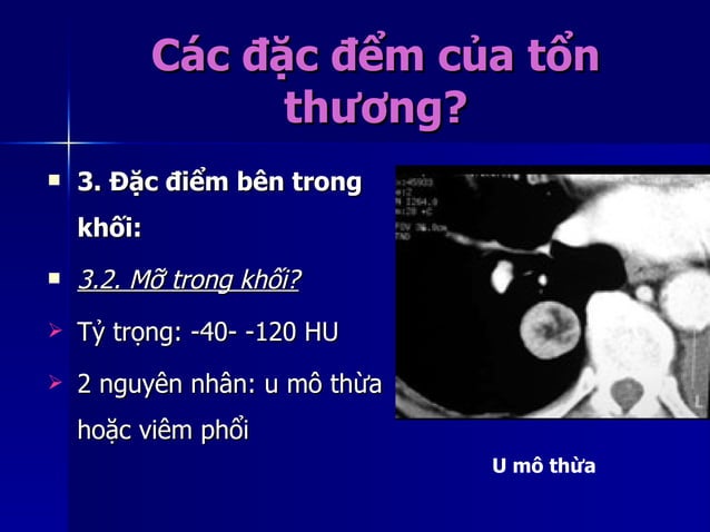 Not don doc phoi trên clvt | PPT