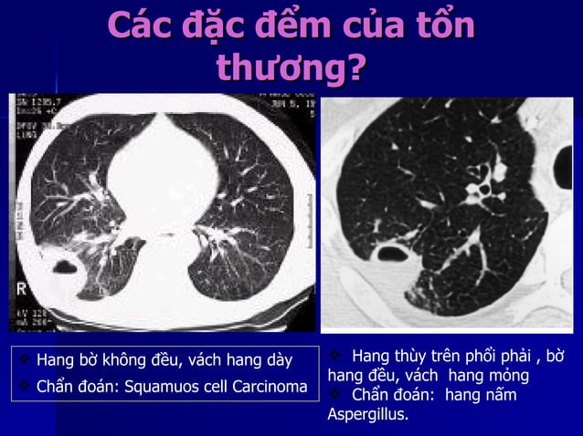 Not don doc phoi trên clvt | PPT