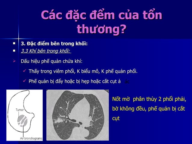 Not don doc phoi trên clvt | PPT