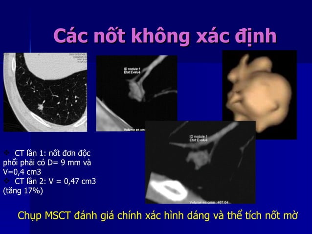 Not don doc phoi trên clvt | PPT