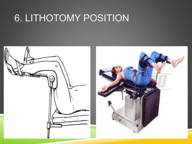 Comfort Positions | PPTX | First Aid | Injuries