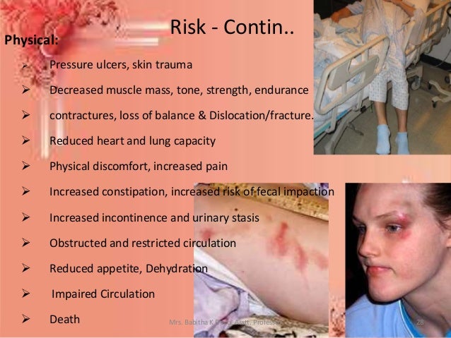 Patient safety Devices - Restraints