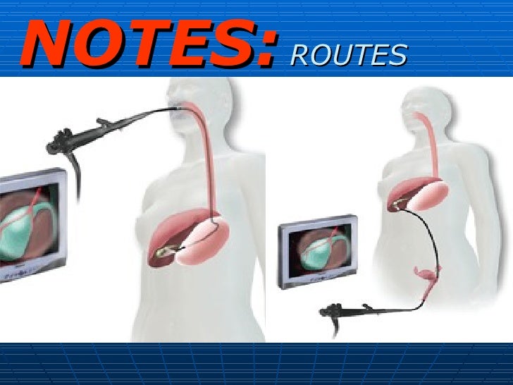 NOTES (Natural Orifice Transluminal Endoscopic Surgery)- By Dr. Onkar