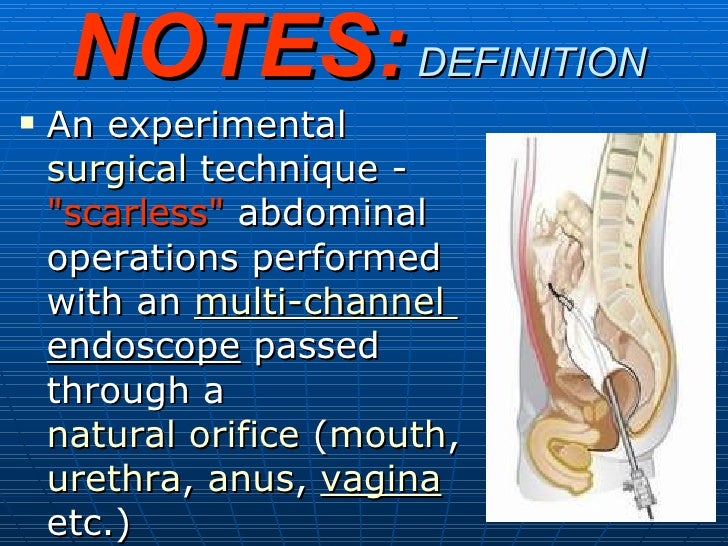 NOTES (Natural Orifice Transluminal Endoscopic Surgery)- By Dr. Onkar