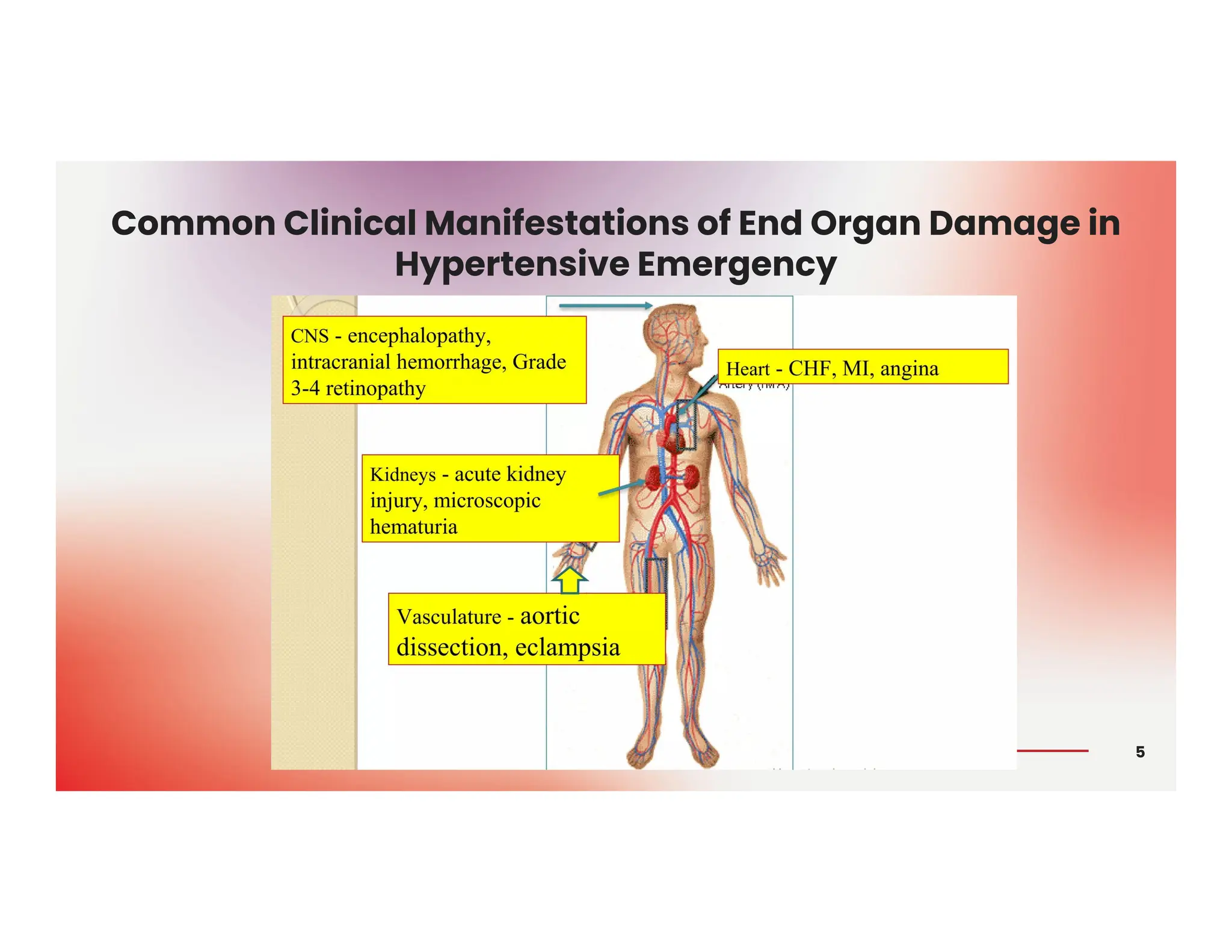 Hypertensive Crises - Urgency and Emergency | PDF