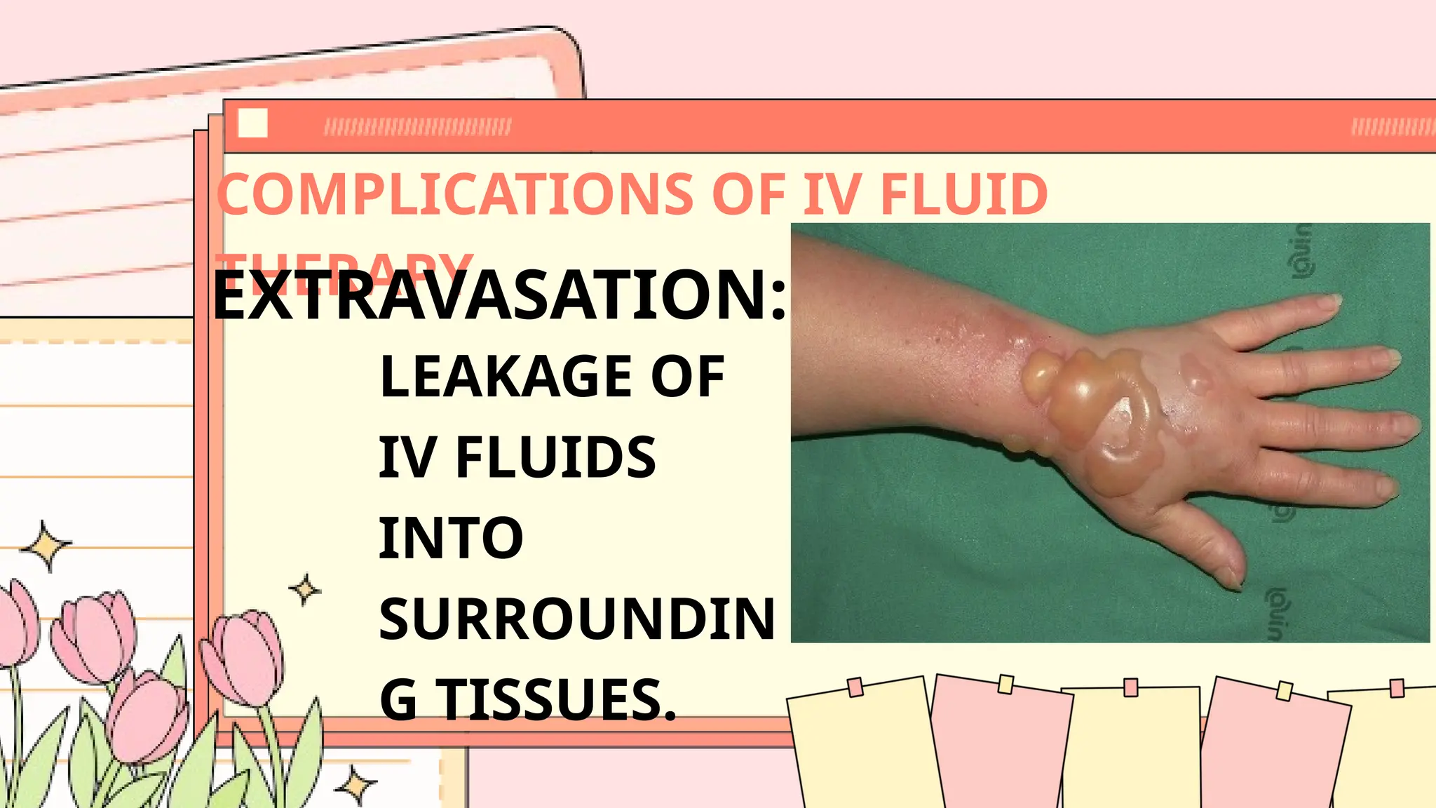 introduction for iv infusion therapy - simplified | PPT