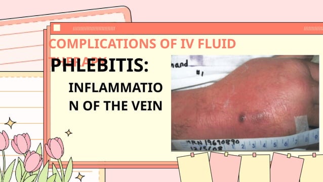 introduction for iv infusion therapy - simplified | PPT