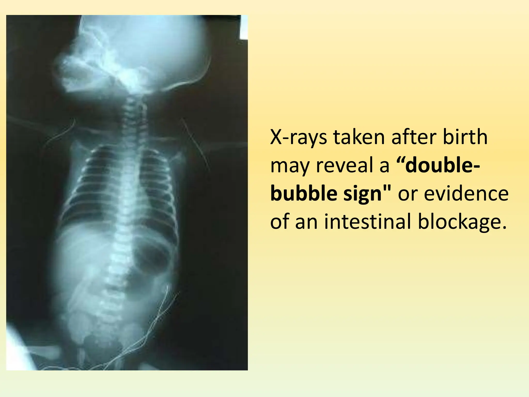 Digestive system in children, semiotics of the digestive organ.pptx ...