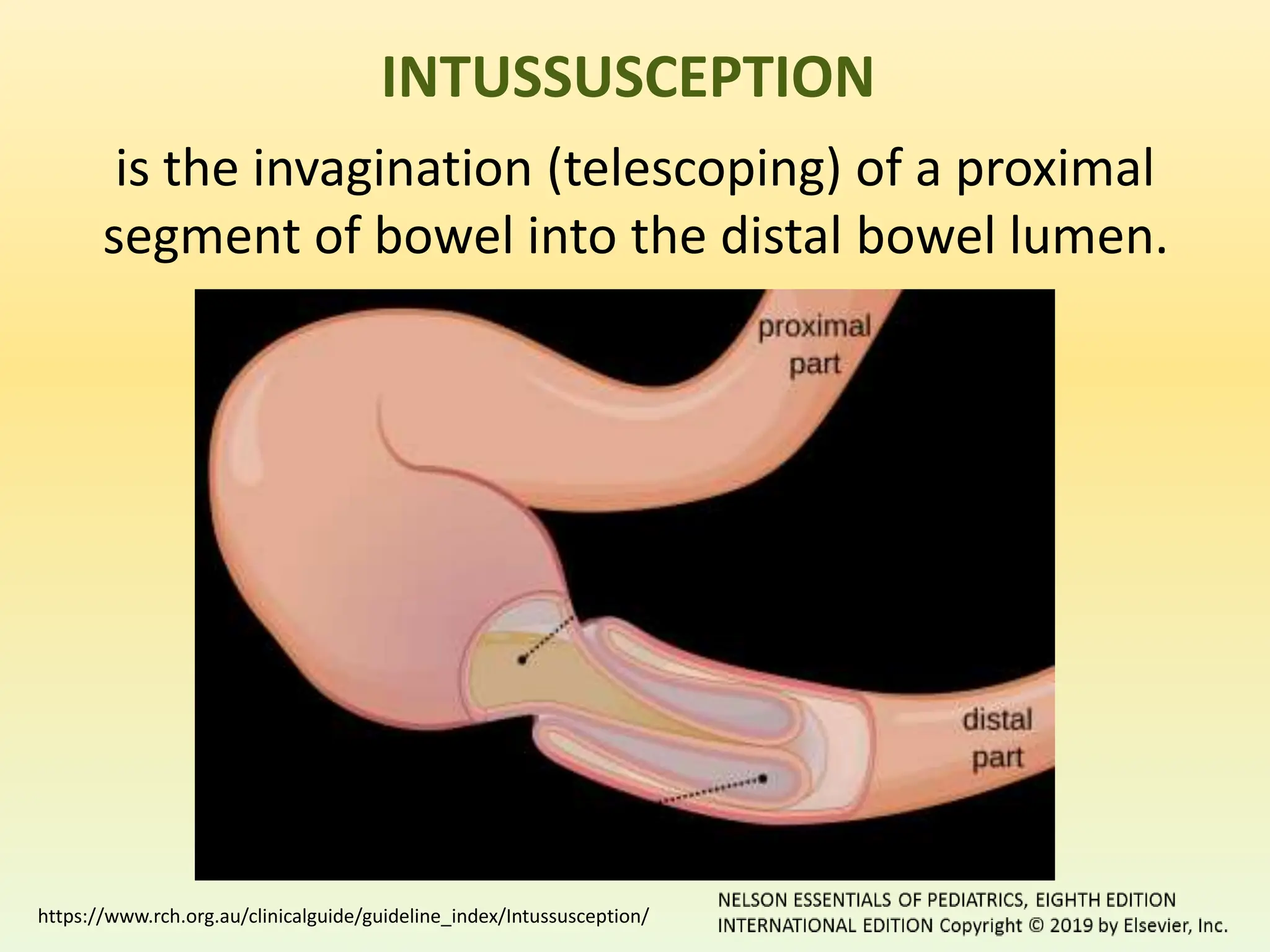Digestive system in children, semiotics of the digestive organ.pptx