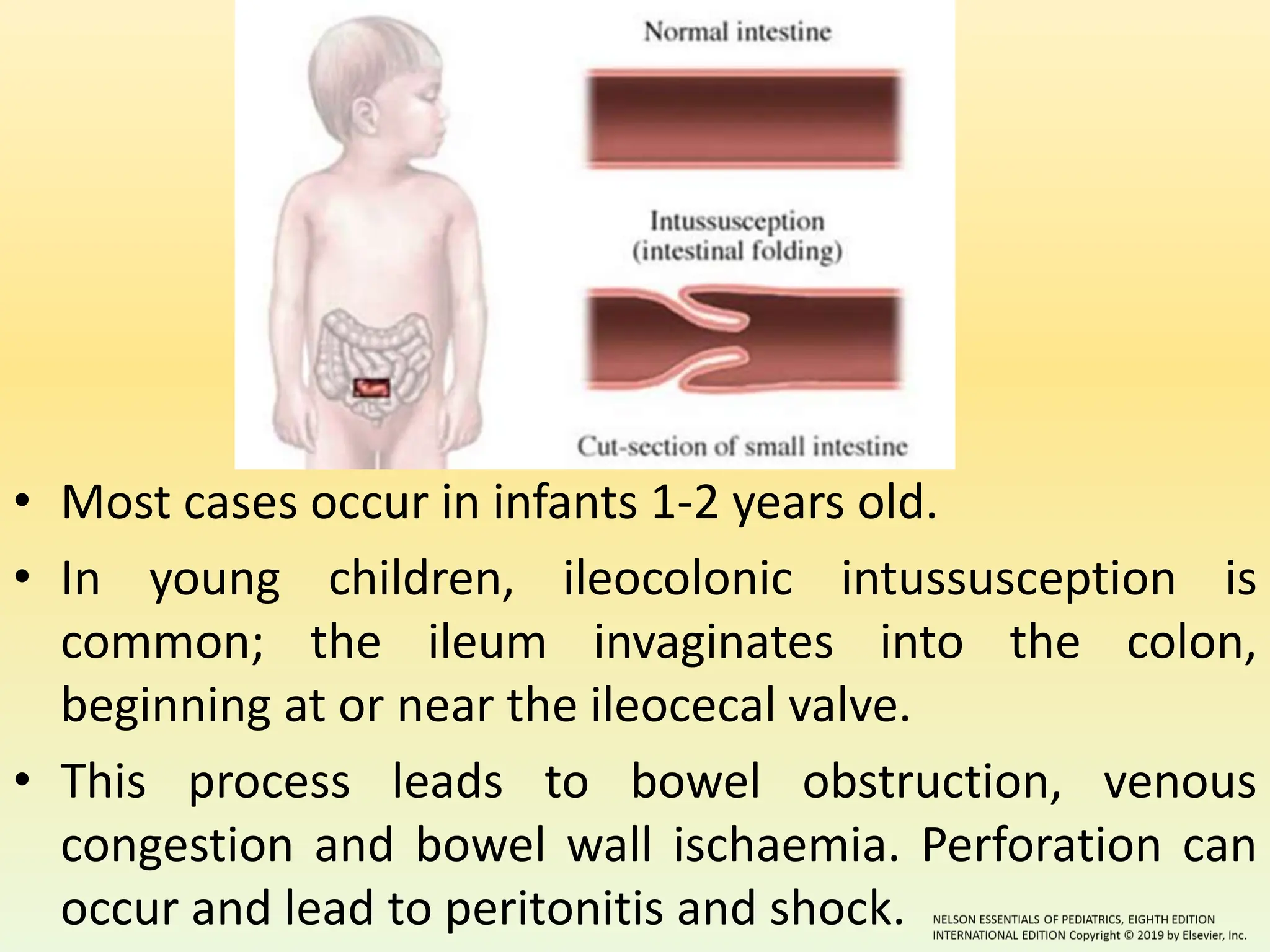 Digestive system in children, semiotics of the digestive organ.pptx