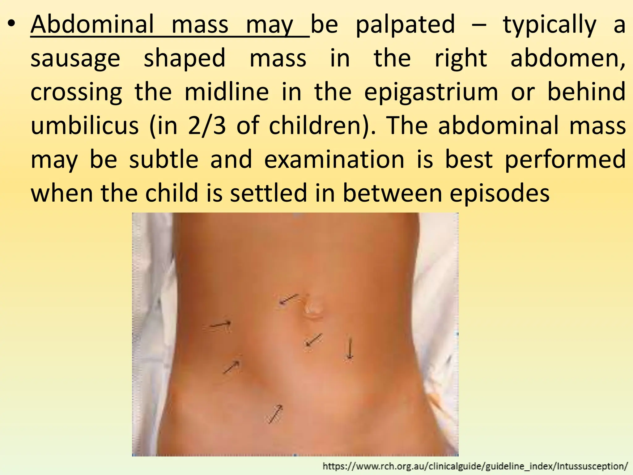 Digestive system in children, semiotics of the digestive organ.pptx